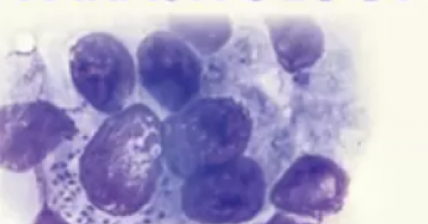 Essentials of Medical Parasitology by Sastry Apurba Sankar