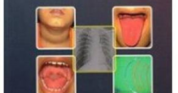 Practical Aspects Of Pediatrics 2012 by Mayoor K. Chheda Practical Aspects Of Pediatrics 2012 by Mayoor K. Chheda